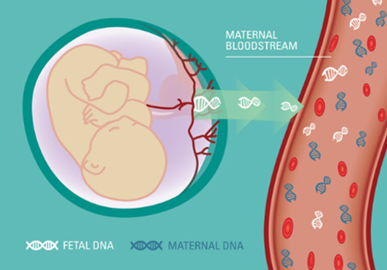 Prélèvement DPNI - Medina